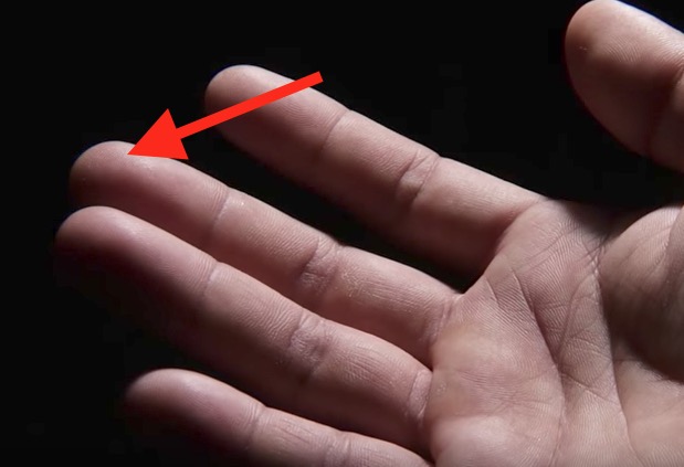 Ihmisen sormenpäät hikoilevat — mikroskoopin alla sekin näyttää kamalalta